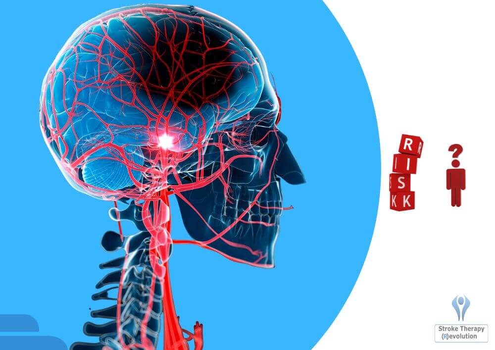 Ataque Isquémico Transitorio - Conoce los síntomas
