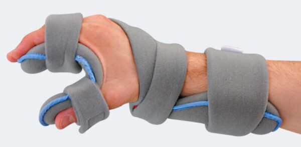 Ferula para la mano en pacientes con ACV - Stroke Therapy (R)evolution