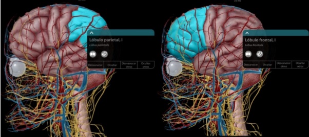 Malformación Arteriovenosa (MAV): Causas y tratamiento