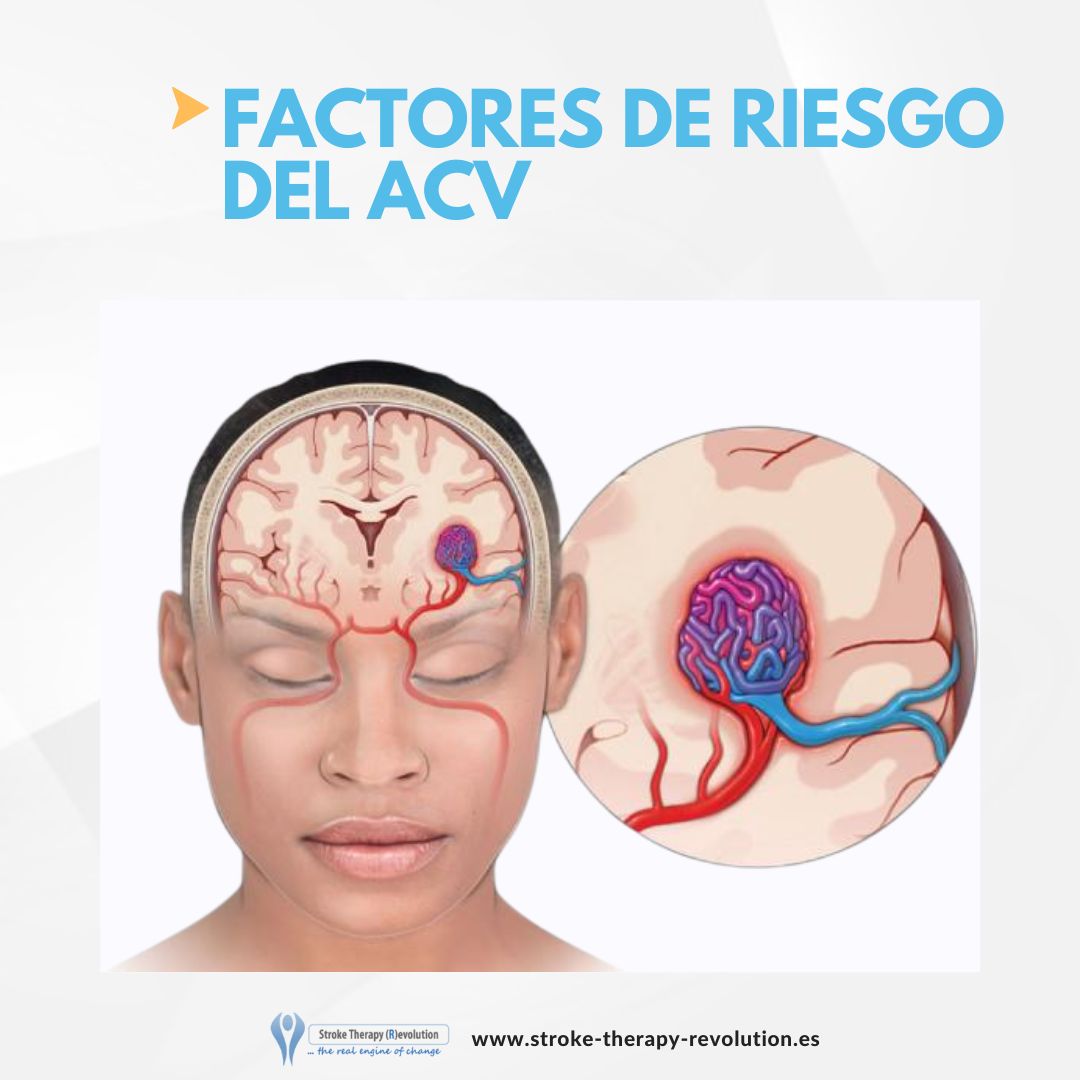 FACTORES DE RIESGO DEL ACV - Stroke Therapy Revolution
